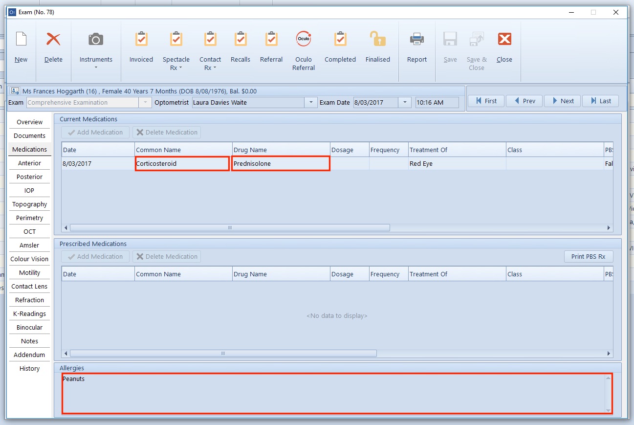 What information is transferred to Oculo from Optomate Touch when ...