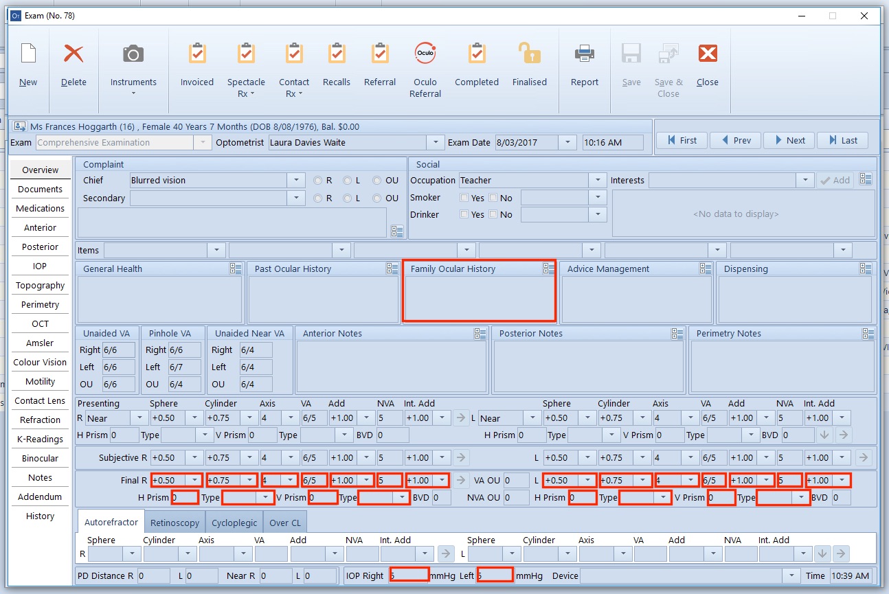 What information is transferred to Oculo from Optomate Touch when ...